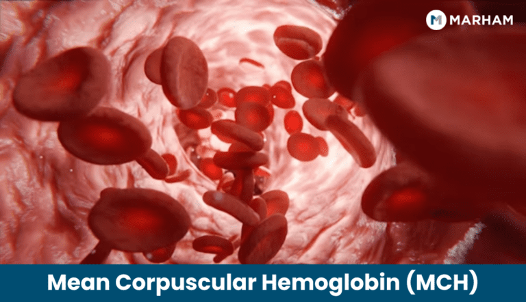MCH Blood Test: Essential Guide to Normal Range, Low & High Levels
